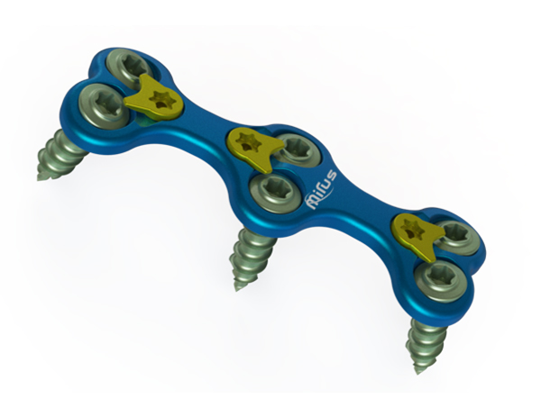 Cygnus Anterior Cervical Plate System - Amp Surgical